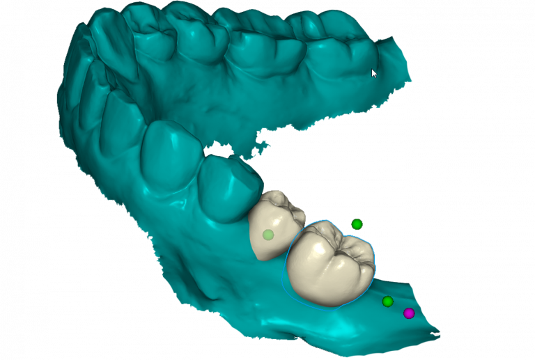 Atomica AI; Implant Guided Surgery Software - Atomica AI